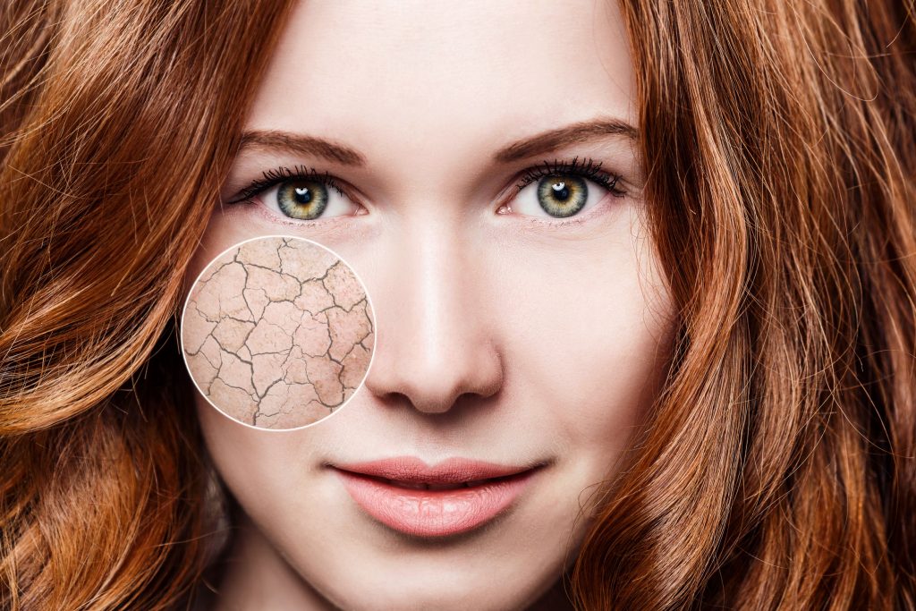 What Type of Skin Do I Have? - Beverly Hills MD