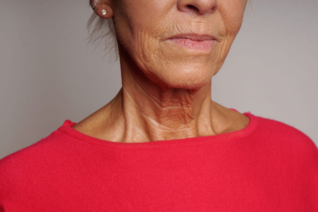 How To Get Rid Of Crepey Skin (and why it happens) - Beverly Hills MD