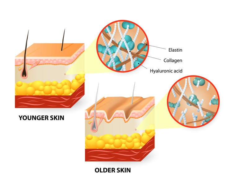 Effects And Signs Of Aging Skin - Beverly Hills MD