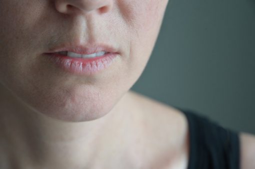 Wind Burned Lips: Here's How To Keep Your Pout Moisturized This Winter ...