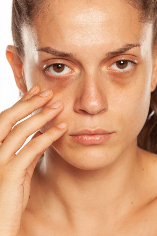 Here's How To Properly Care For Delicate Skin Around The Eyes - Beverly ...