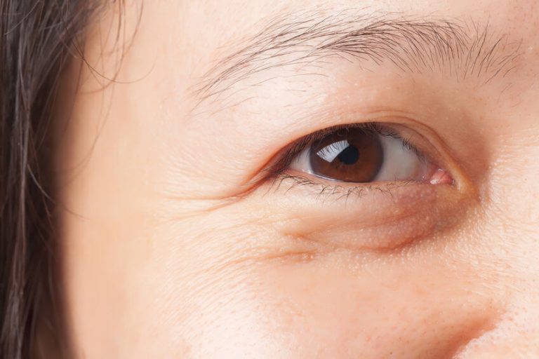 Ever Wonder What Causes Wrinkles Under Eyes? Here's How To Help Prevent ...