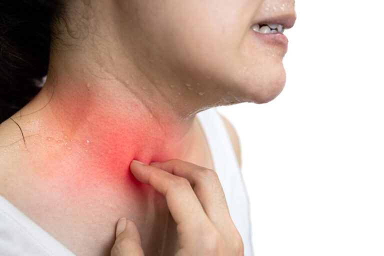 Is Sweating Good For Your Skin? - Beverly Hills MD