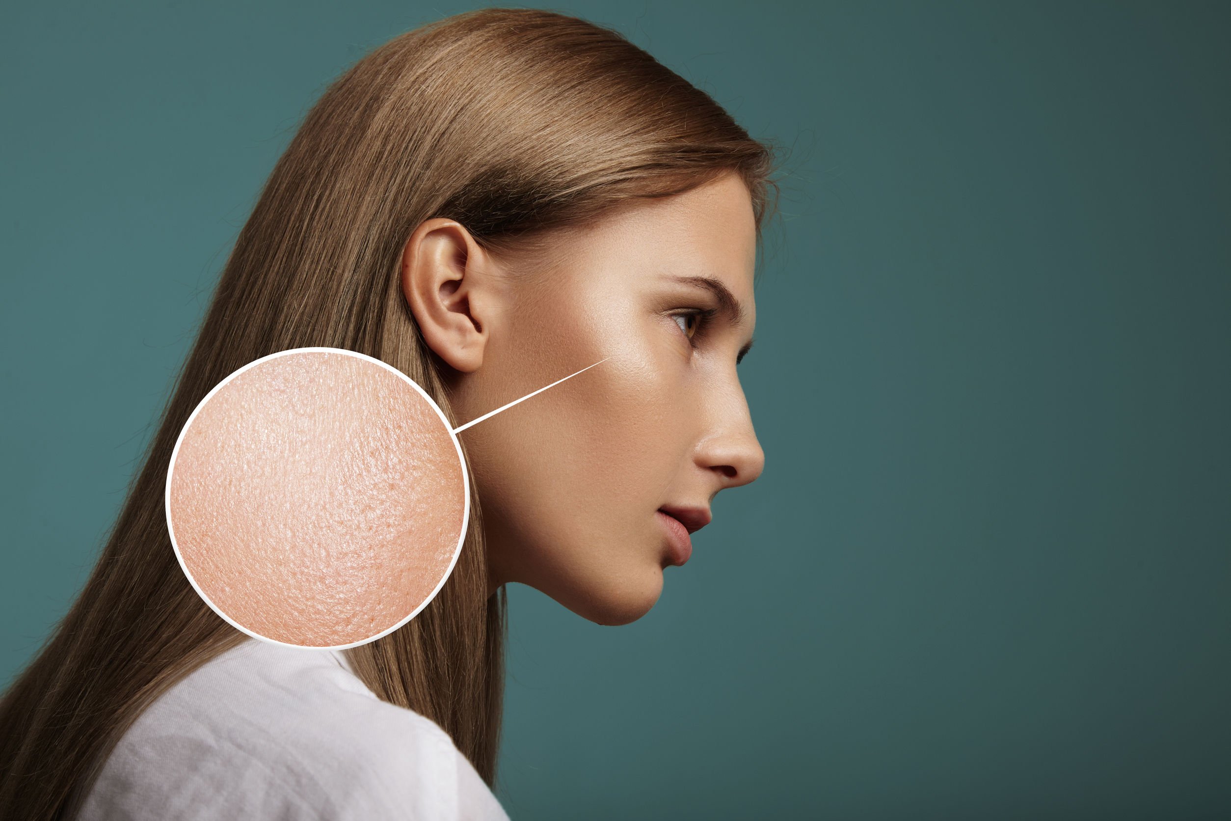 What Causes Large Pores (and can you shrink them?) | Beverly Hills MD