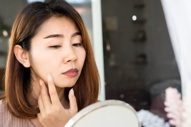 Wind-Burned Lips: Causes, Relief & Prevention | Beverly Hills MD